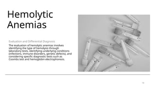 Anemia Work Up and Evaluation of Different Causes.pptx