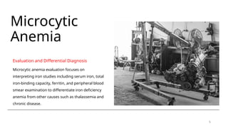 Anemia Work Up and Evaluation of Different Causes.pptx