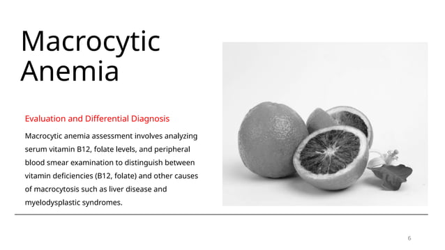 Anemia Work Up and Evaluation of Different Causes.pptx