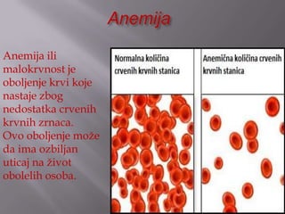 Anemija | PPTX