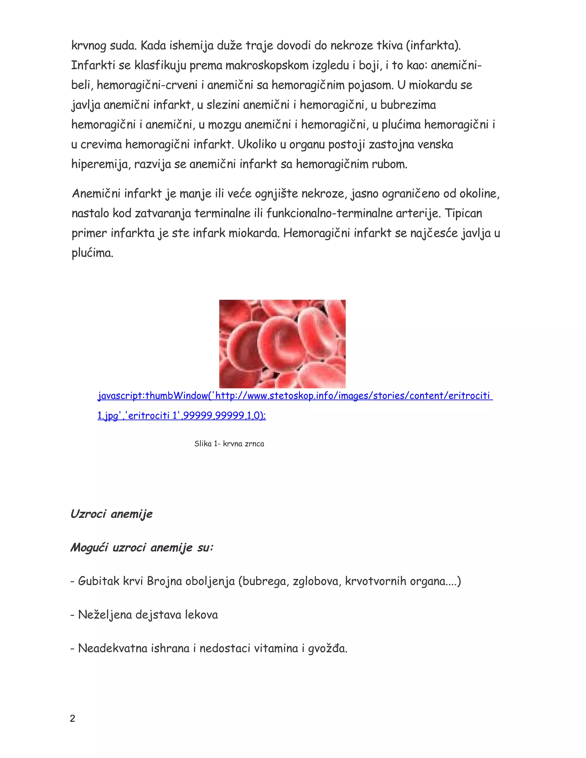 Anemije opsta medicina | DOC
