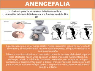 Anencefalia | PPTX