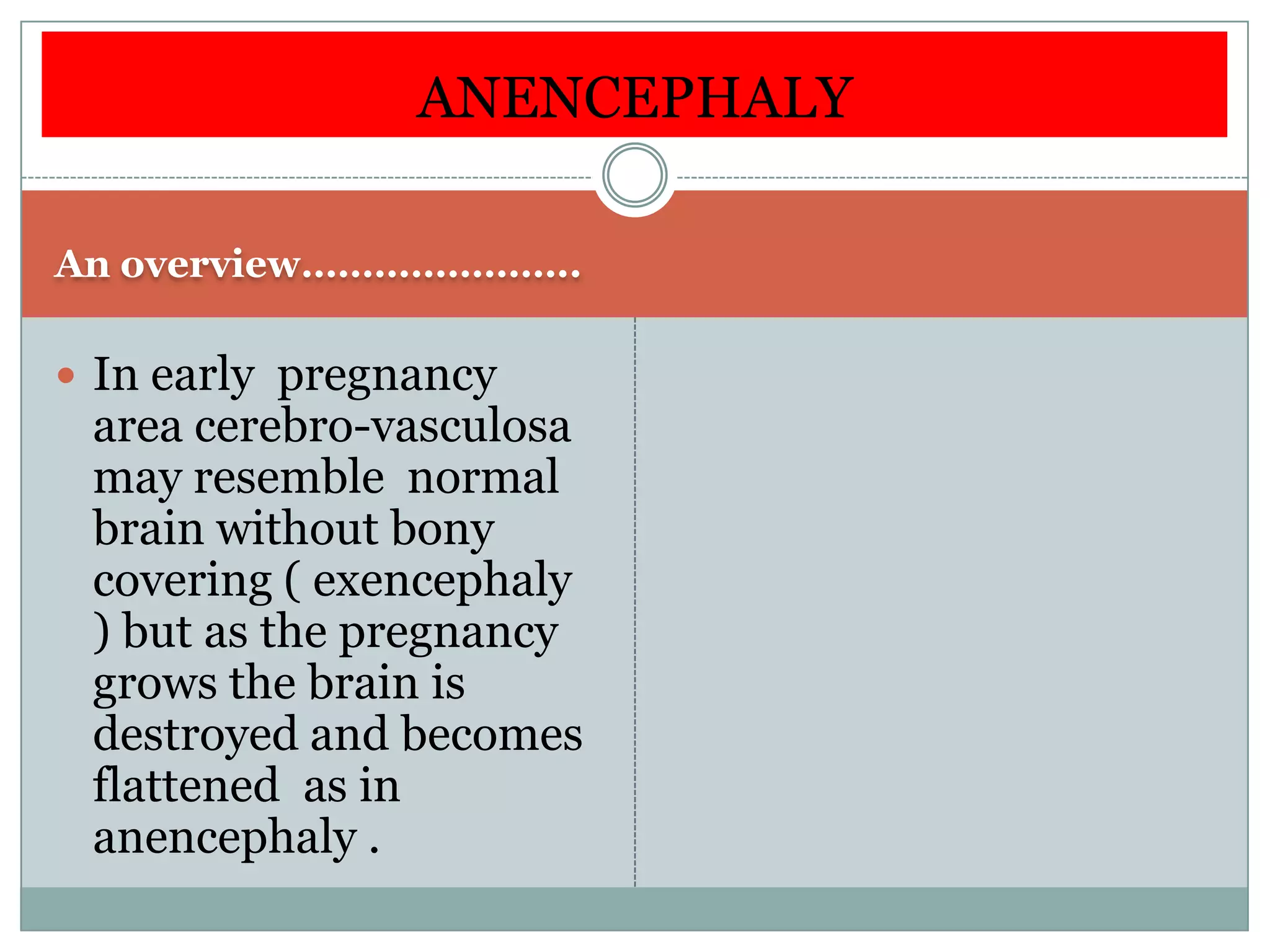 Anencephaly | PPTX