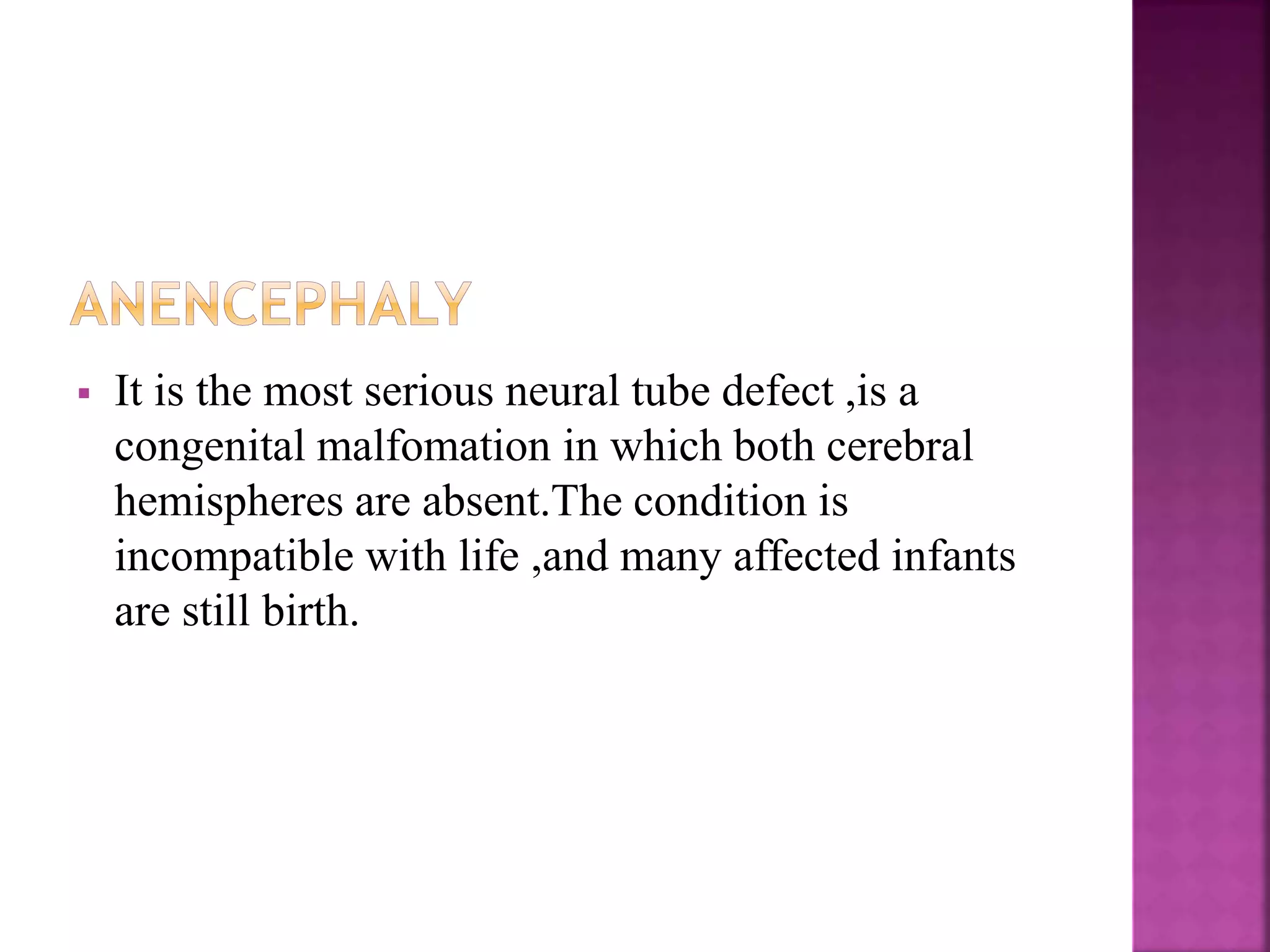 anencephaly.pptx