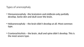 anencephaly.pptx for obstetric and gynac | PPTX