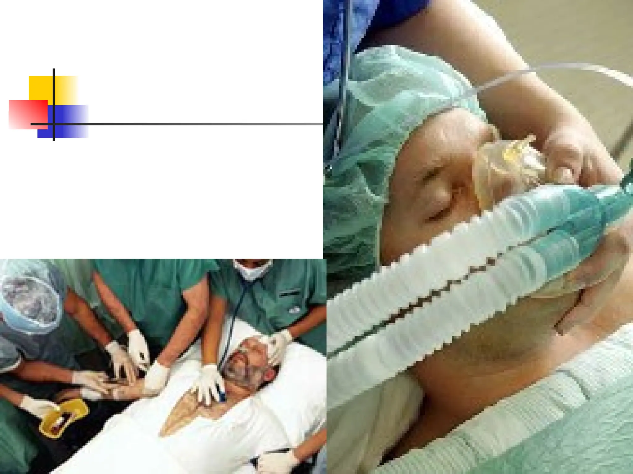 obat- obatan anestesi-lokal-dan-umum.ppt