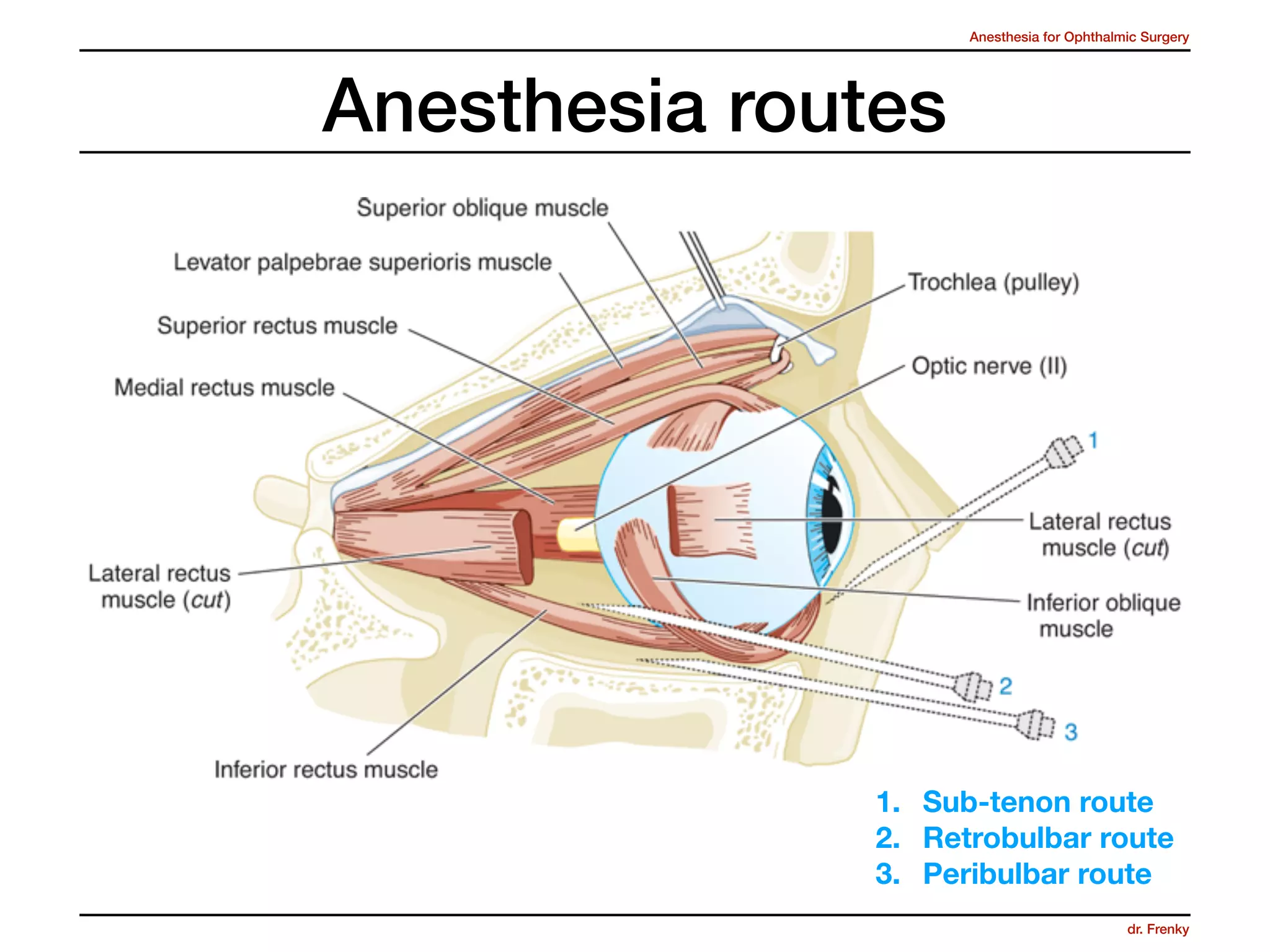 Anesthesia for Ophthalmic Surgery | PDF