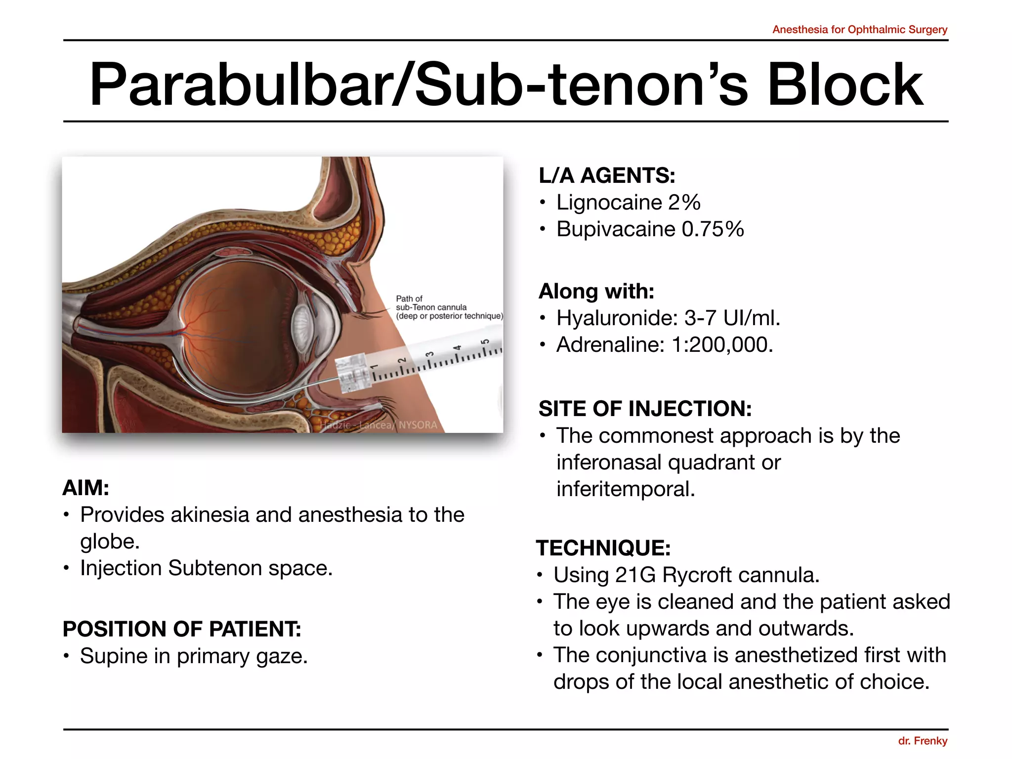 Anesthesia for Ophthalmic Surgery | PDF