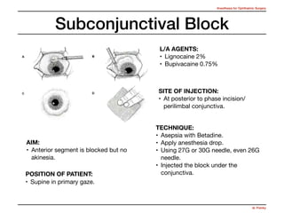 Anesthesia for Ophthalmic Surgery | PDF