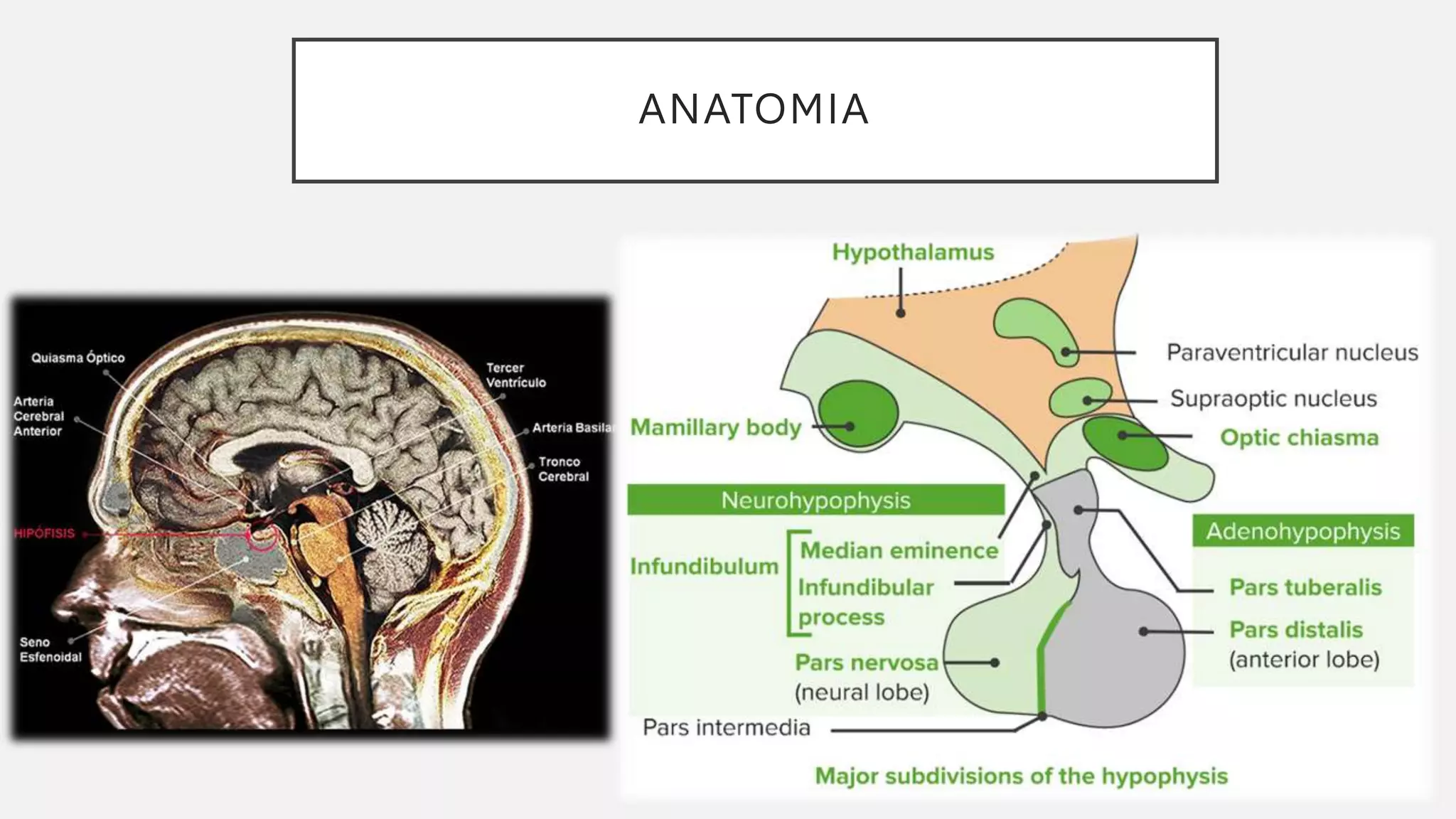 ANESTESIA CIRUGIA HIPOFISIS.pptx | Endocrine and Metabolic Diseases ...