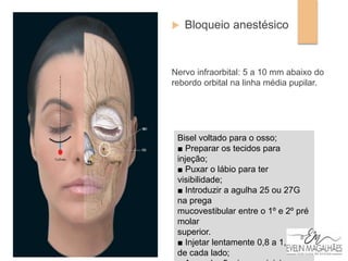 Anestesia da face.pptx