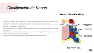 Anestesia en cirugía de hipófisis.pptx