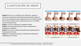 ANESTESIA EN CIRUGIA DE HIPOFISIS.pptx