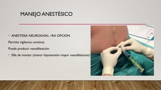 anestesia en cirugia urologica.......pptx