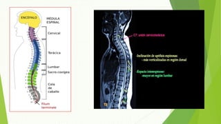 Anestesia intradural | PPTX