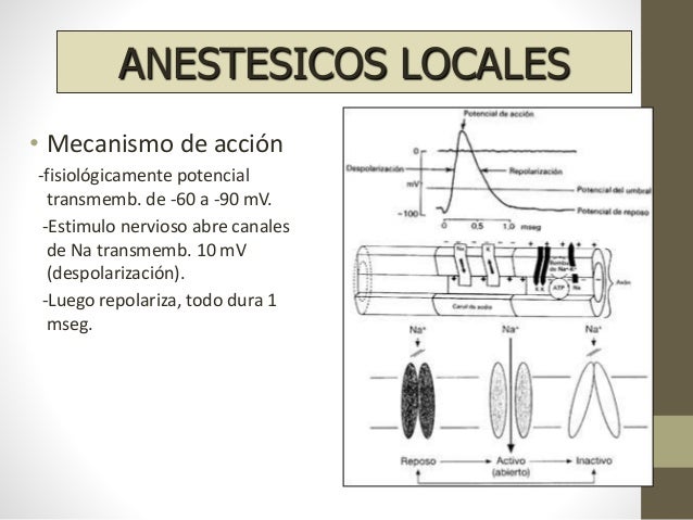Anestesia Local