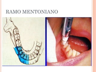 Odontologia- Anestesia local | PPT | First Aid | Injuries