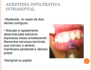 Odontologia- Anestesia local | PPT