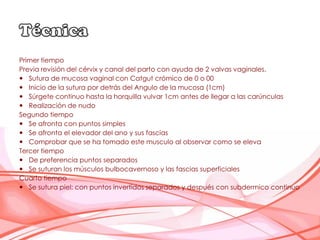 Episiotomia/Episiorrafia | PPTX