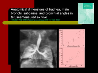 Anestesia neonatal | PPS