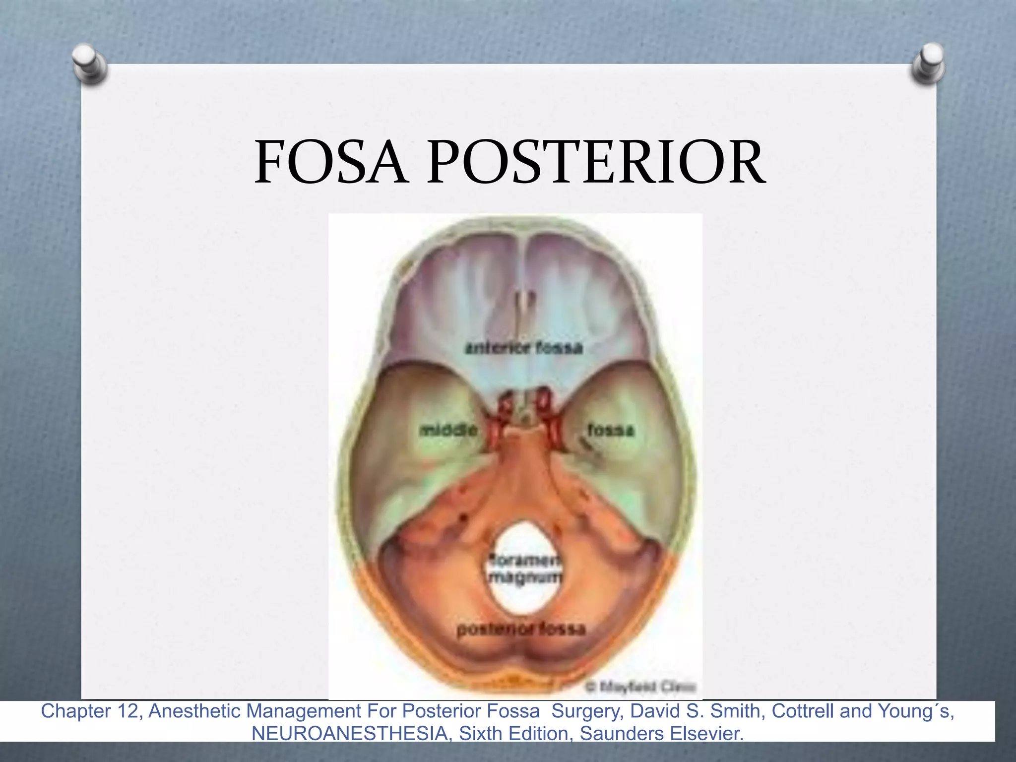 Anestesia para fosa posterior | PDF