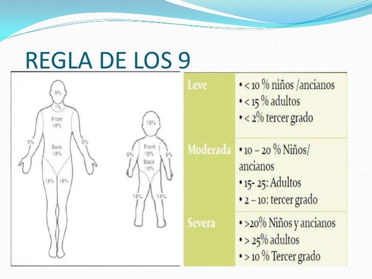 Anestesia para paciente quemado pediatrico