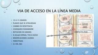 ANESTESIA RAQUIDEA.pptx