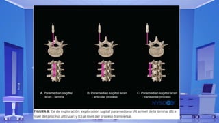 ANESTESIA RAQUIDEA.pptx
