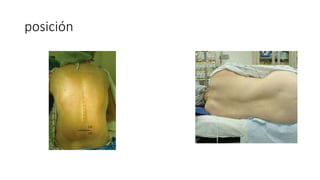 Anestesia Raquidea.pptx