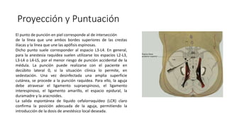 Anestesia Raquidea.pptx