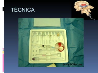 Anestesia Raquidea | PPT