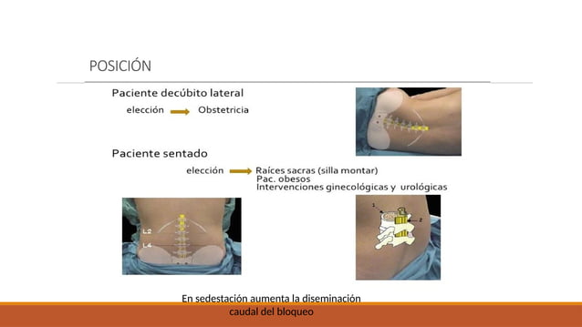 ANESTESIA RAQUIDEA ACTUAL ASPECTOS FISIOLOGICOS.pptx | Descarga Gratuita