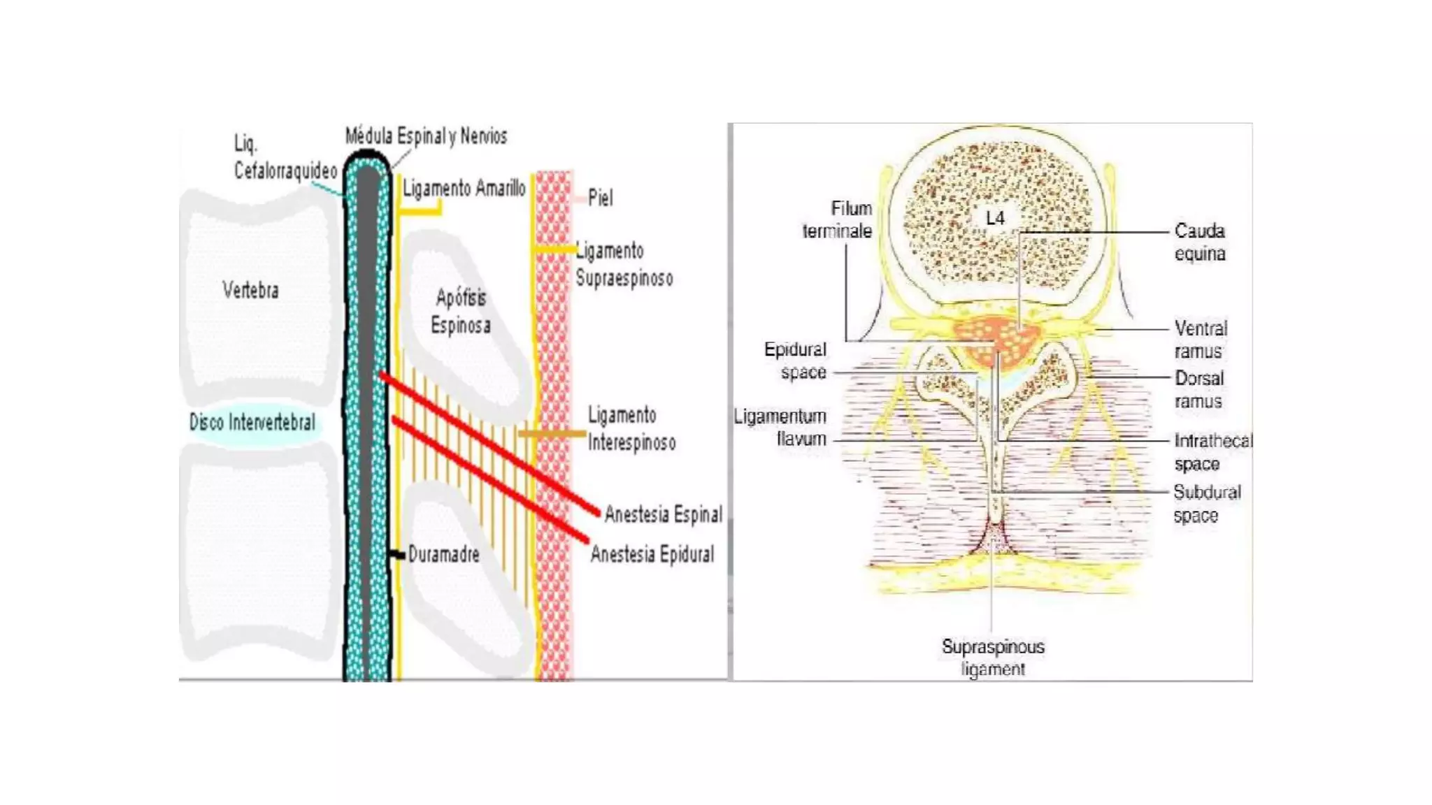 ANESTESIA RAQUIDEA Y EPIDURAL.pptx | Surgery | Medical Health