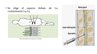ANESTESIA RAQUIDEA Y EPIDURAL.pptx