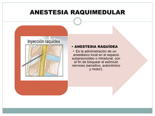 ANESTESIA RAQUIMEDULAR.pptx