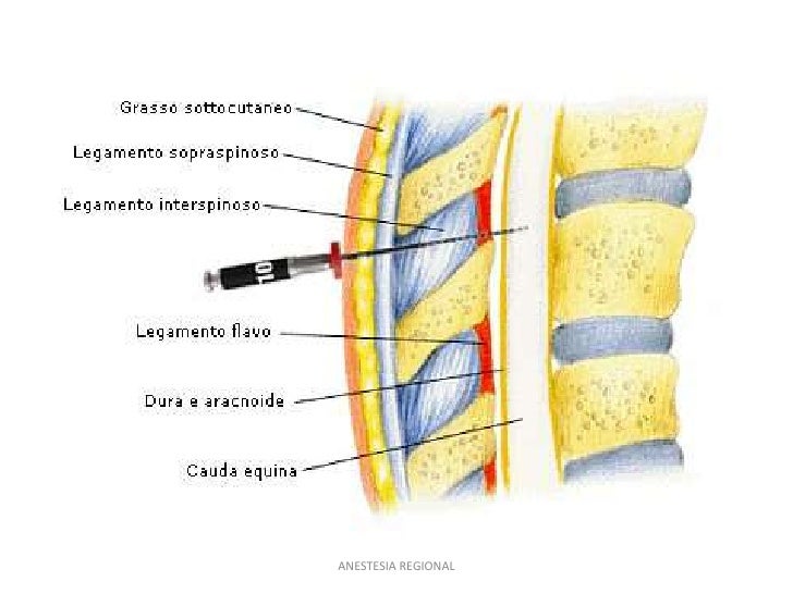 ANESTESIA REGIONAL at emaze Presentation