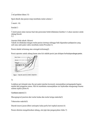 Anestesi lokal | DOC