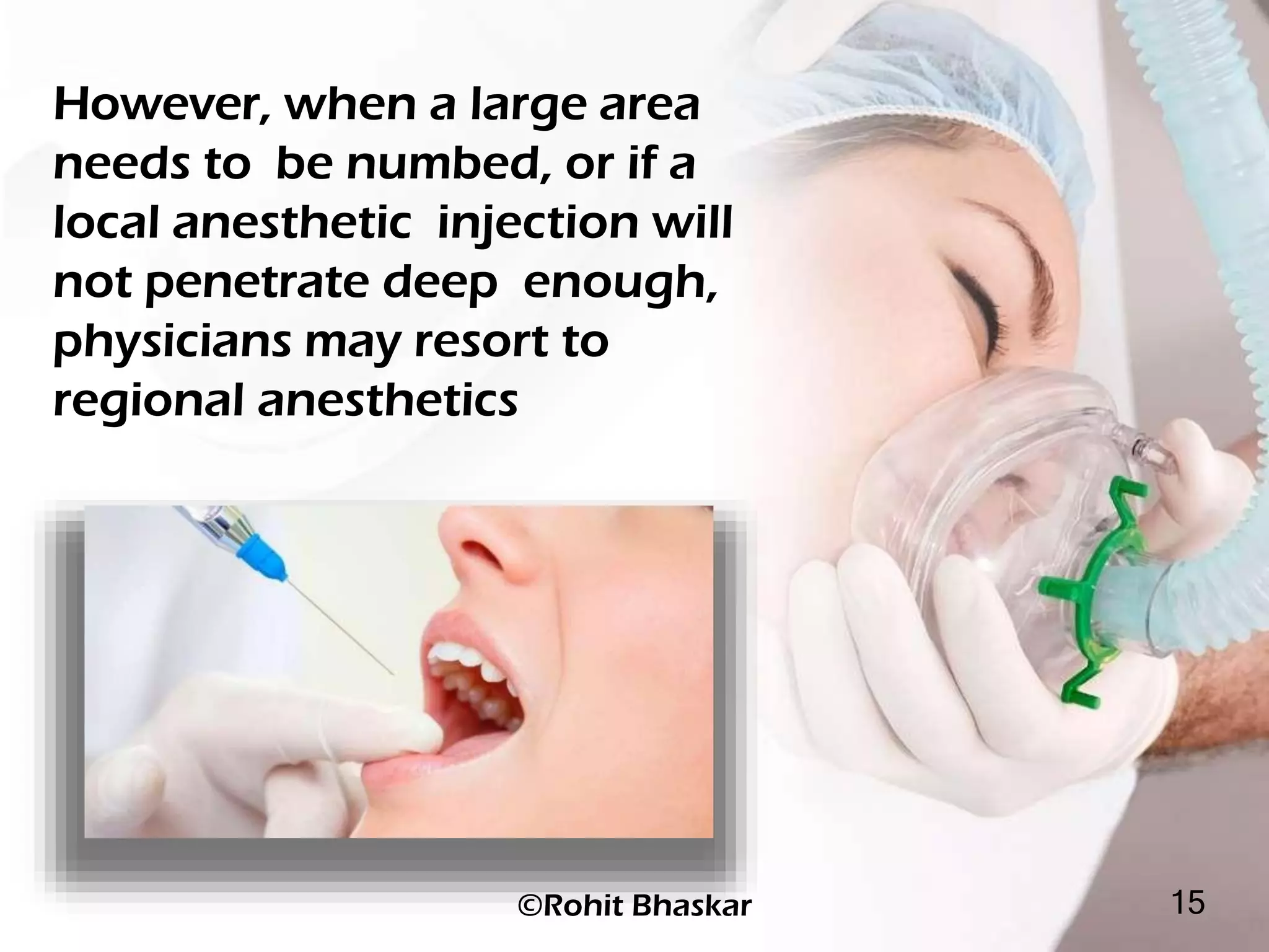 Anesthesia I Types, Stages, Complications - Dr Rohit Bhaskar | PDF