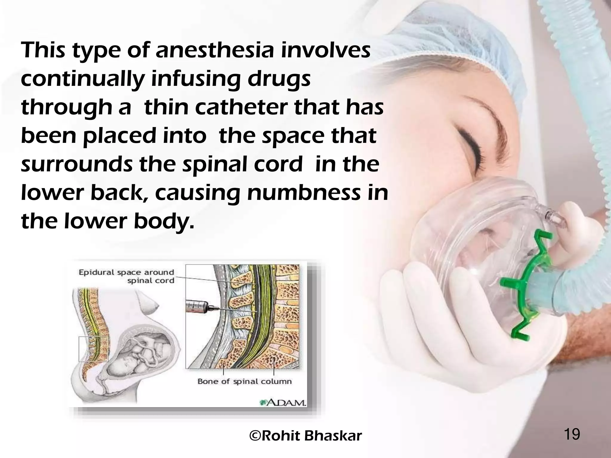 Anesthesia I Types, Stages, Complications - Dr Rohit Bhaskar | PDF