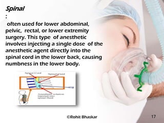 Anesthesia I Types, Stages, Complications - Dr Rohit Bhaskar | PDF