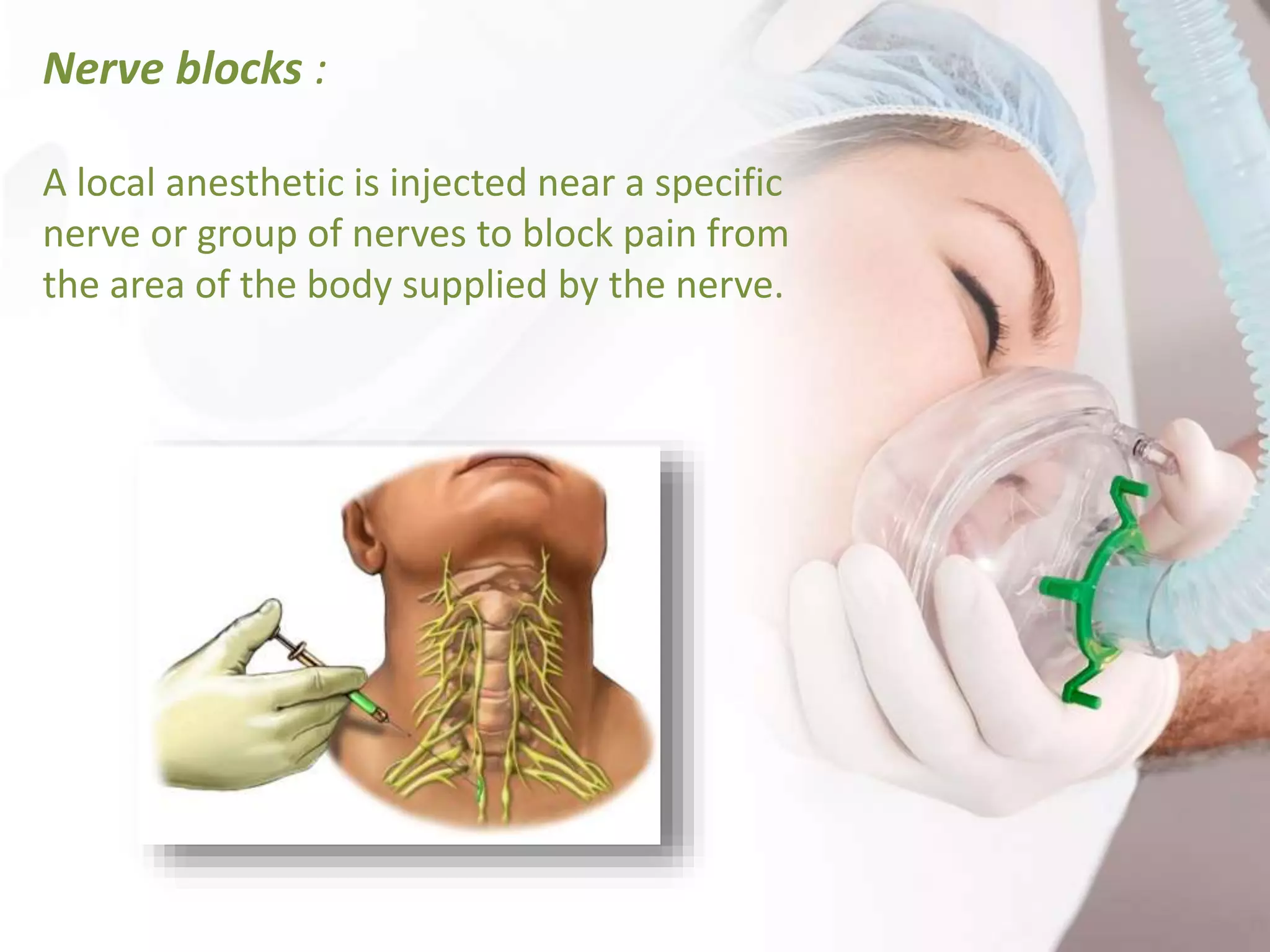 Anesthesia | PPTX
