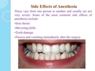 Anesthesia | PPTX