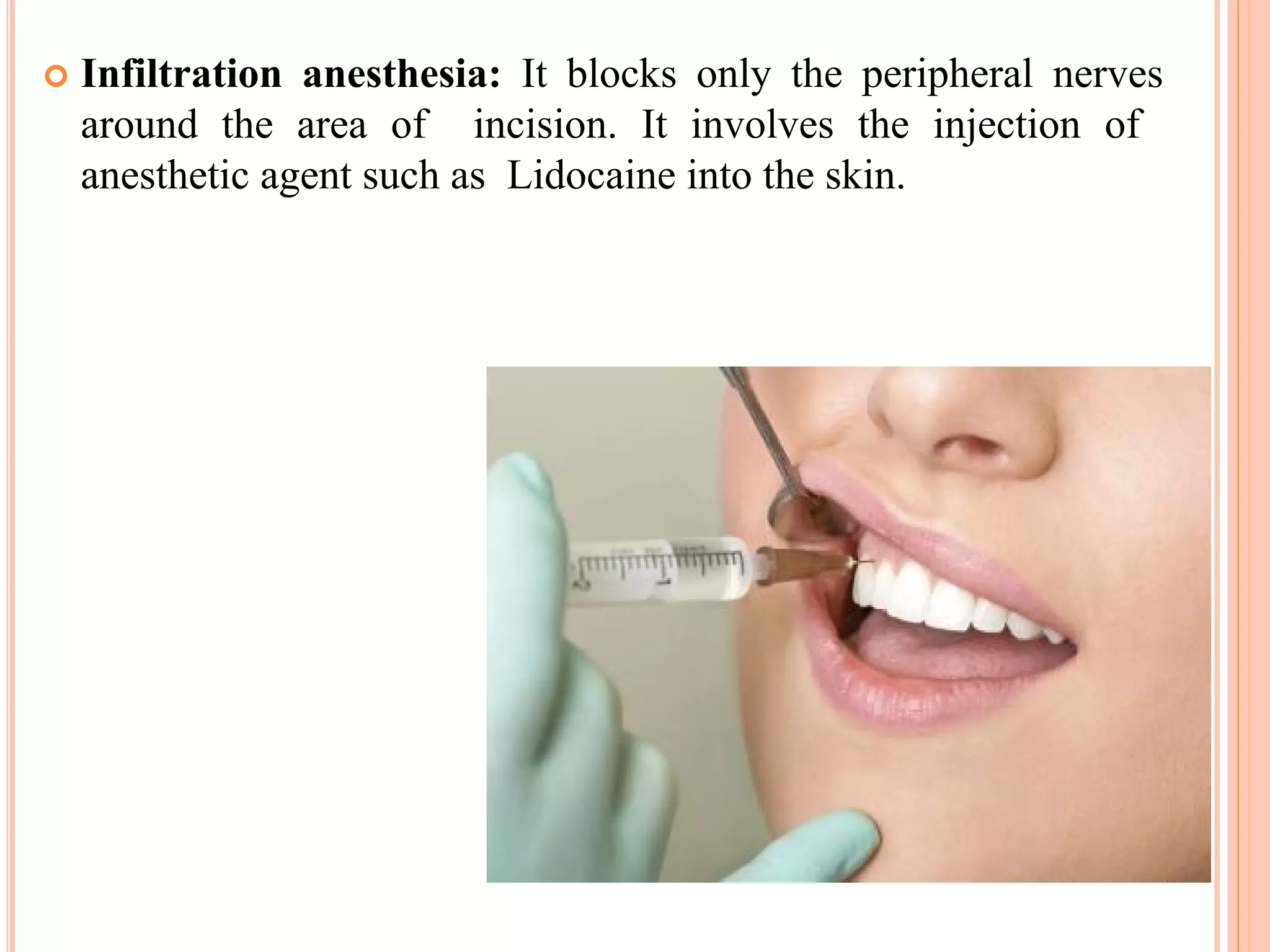 Anesthesia types and complications | PDF
