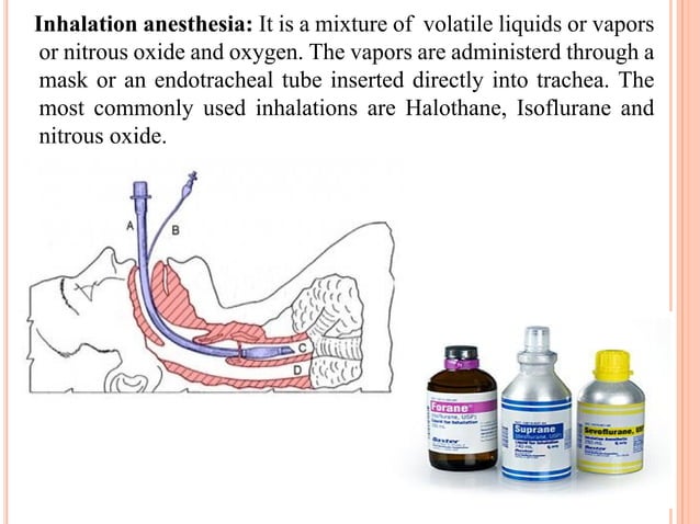 Anesthesia types and complications | PDF | Lung and Respiratory Health ...