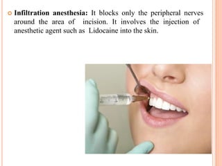 Anesthesia types and complications | PDF