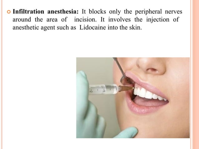 Anesthesia types and complications | PDF | Lung and Respiratory Health ...