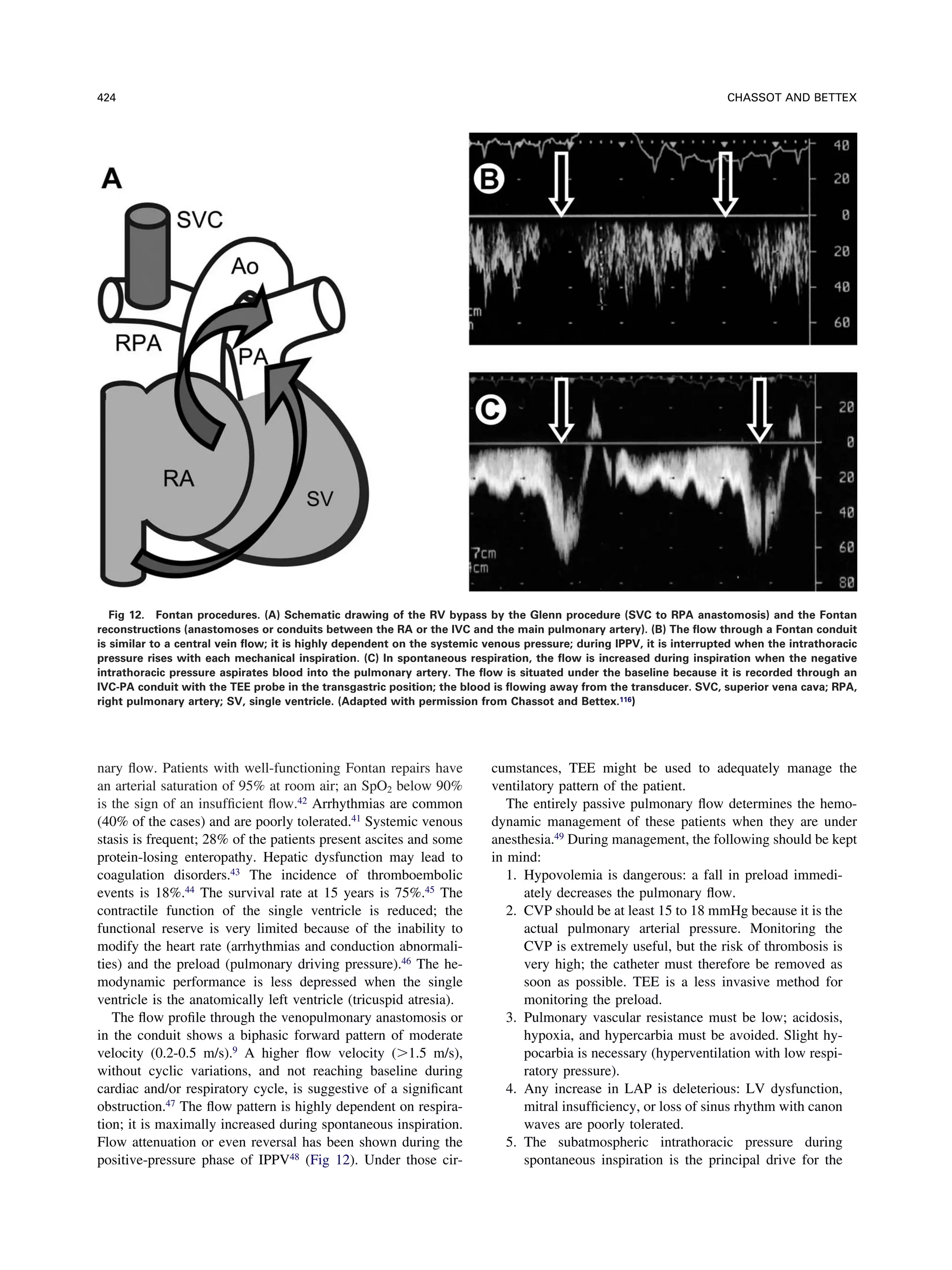 Anesthesia And Congenital Heart Disease | PDF
