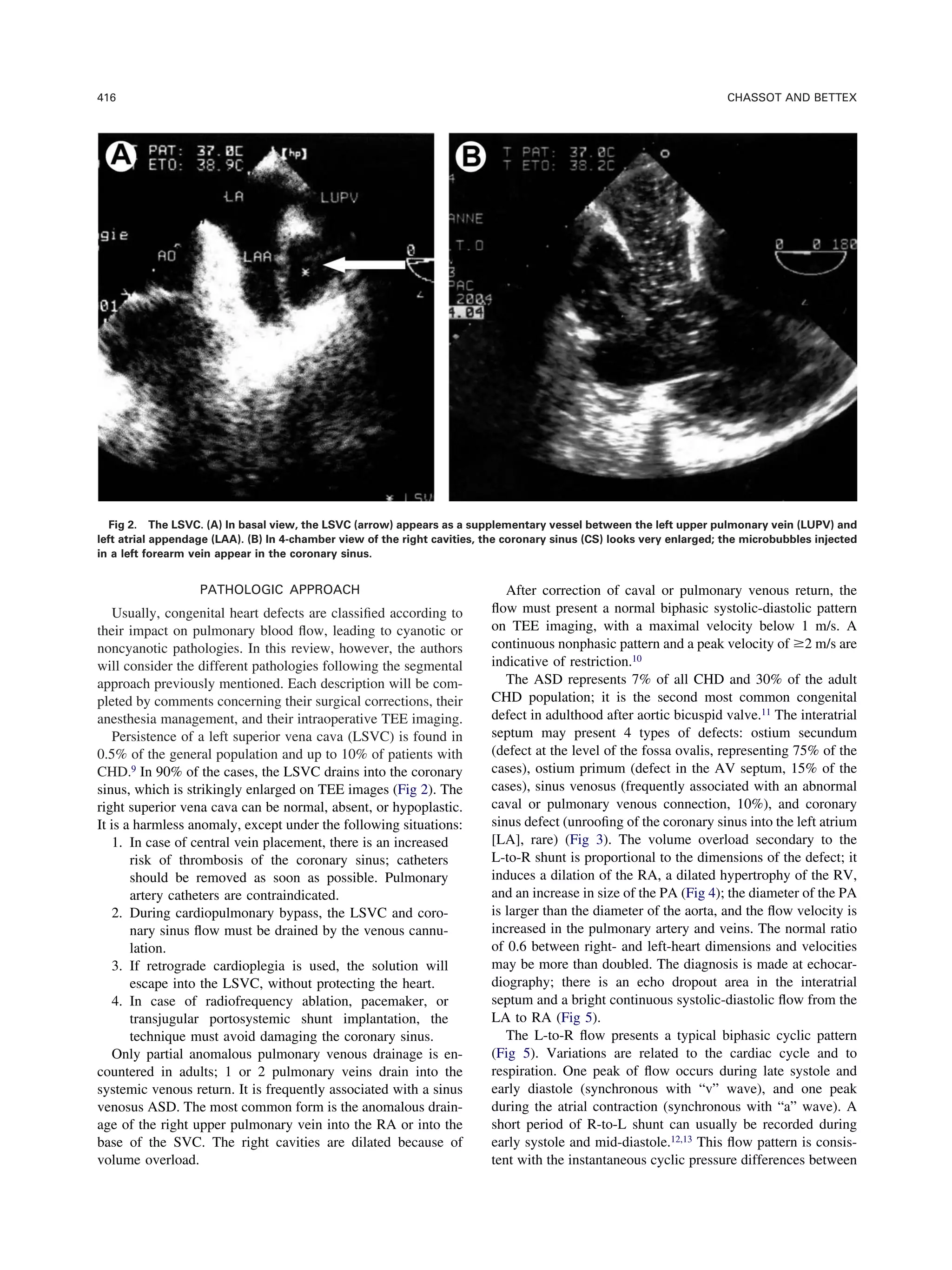 Anesthesia And Congenital Heart Disease | PDF