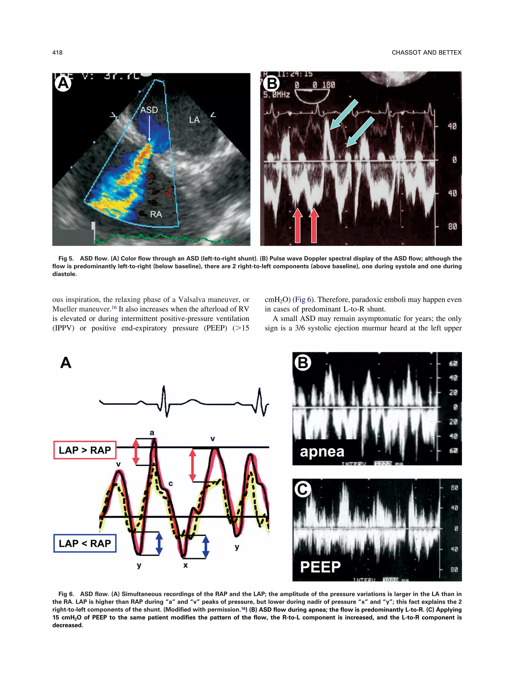 Anesthesia And Congenital Heart Disease | PDF