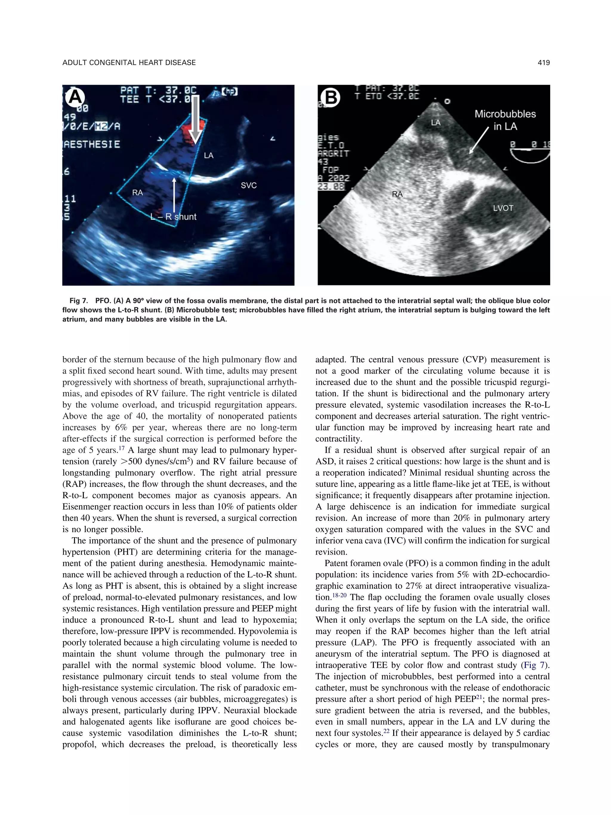 Anesthesia And Congenital Heart Disease | PDF